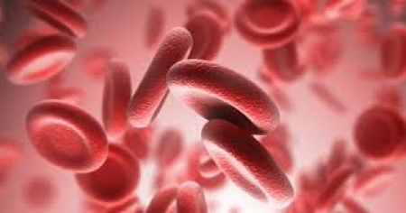 Sicklemia o drepanocitosis