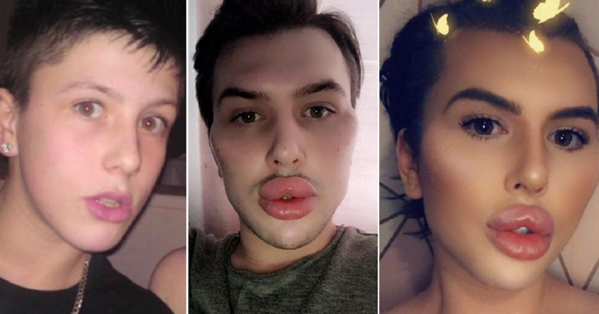 James Holt, el joven obsesionado con parecerse a las Kardashian