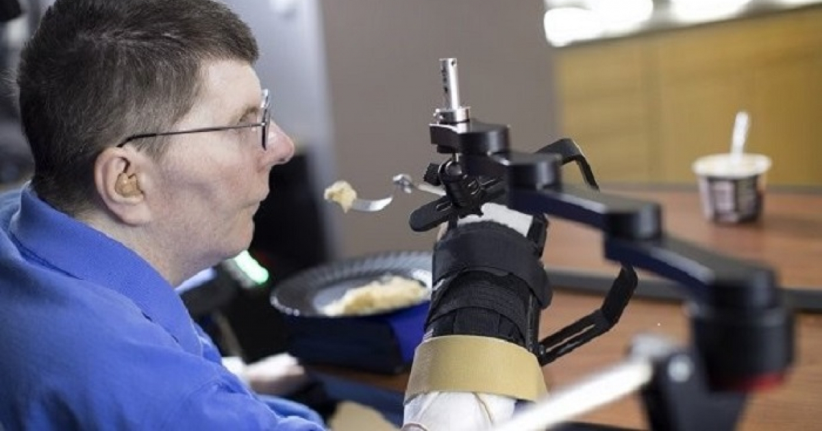 El uso de una neuroprótesis da movimiento al brazo y la mano de ...